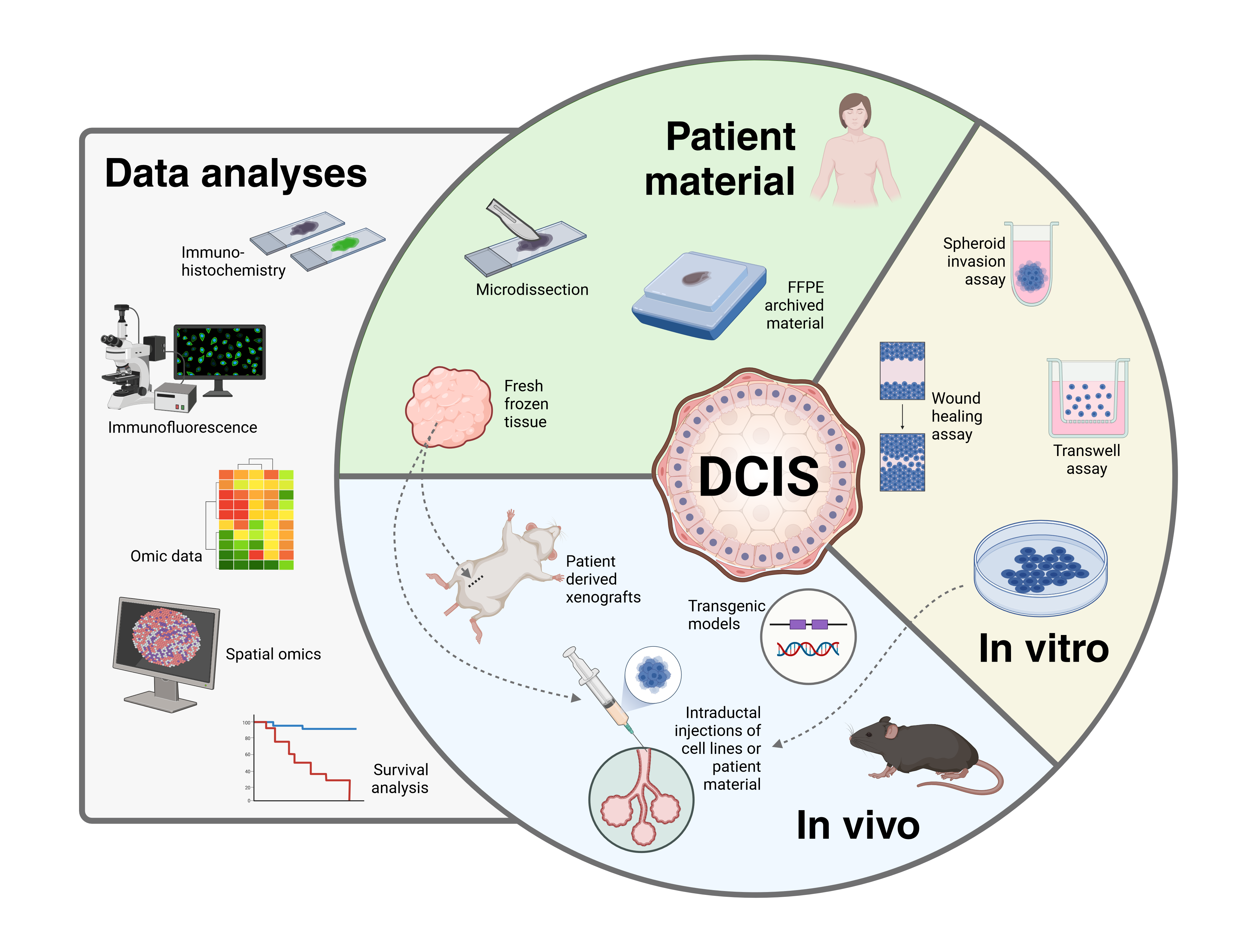 OUH - Ductal Carcinoma In Situ